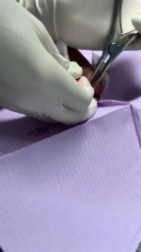 Mistress Damazonia Brought My Gimp To Get A Prince Albert Piercing Today First Step Into A