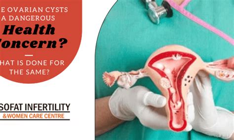 Chocolate Ovarian Cyst