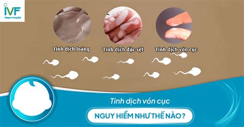 Tinh Dịch Vón Cục Nguy Hiểm Như Thế Nào