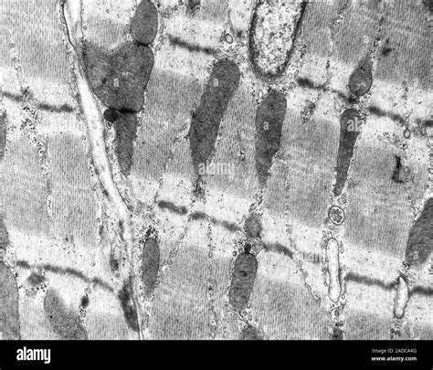 Des Cellules Du Muscle Cardiaque Humaine Noyau Mitochondries L