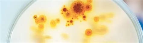 Microbiological Analysis Podhikai