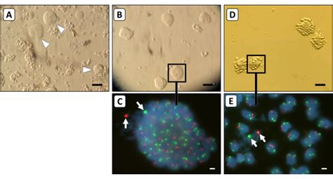Exploring X Chromosomal Aberrations In Ovarian Cells By Using