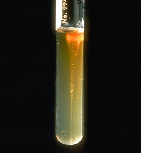 Difference Between Solid Media And Semi Solid Media Compare The