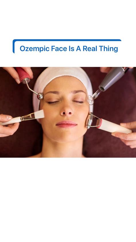 What Is ‘ozempic Face “ozempic Face” Refers To A Hollowed Or Sagging