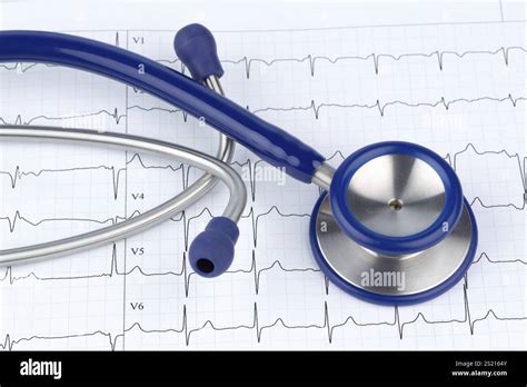 Stethoscope And Electrocardiogram Symbolic Photo For Heart Disease And