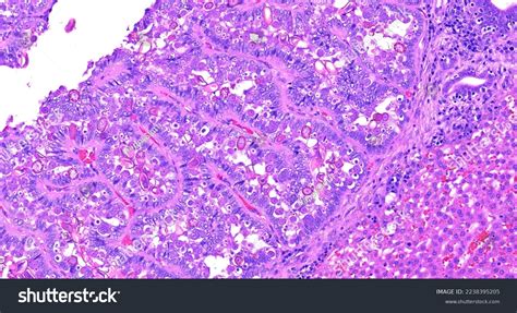 Histología De Los Stiedae De Eimeria Foto De Stock 2238395205 Shutterstock
