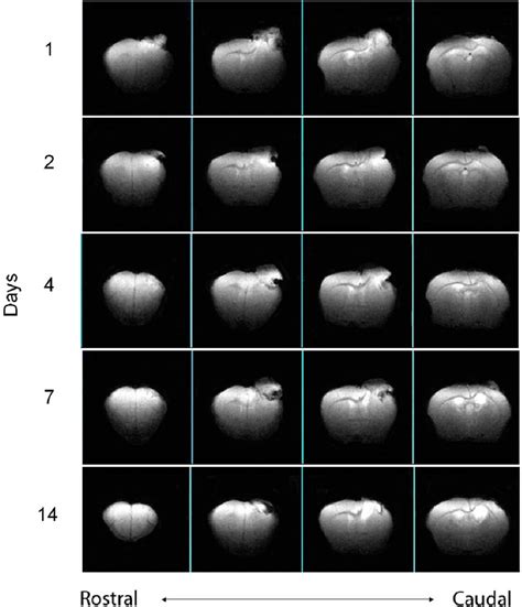 figure 1 from a mouse model of sensorimotor controlled cortical impact