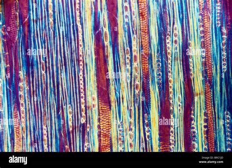 Light Micrograph Lm Of A Longitudinal Section Showing Xylem Elements