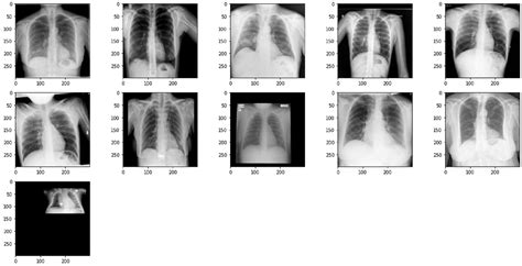 Applied Sciences Free Full Text Enhancing An Imbalanced Lung Disease X Ray Image