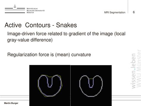ppt level set methods for imaging and application to mri segmentation