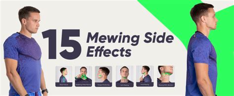 Risks And Side Effects Of Improper Mewing 15 Tips To Avoid Them