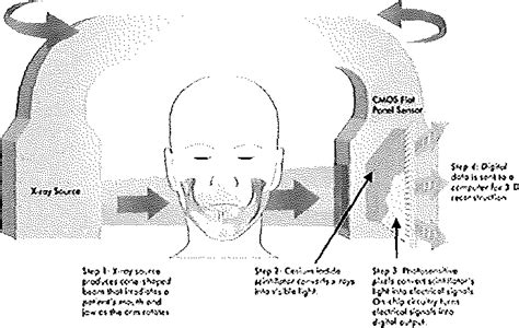 Table 1 From A Clinical Evaluation Of Cone Beam Computed Tomography Semantic Scholar