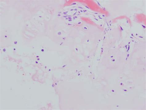 Haematoxylin And Eosin Stained Section Mag ×100 Mildly Disordered Download Scientific Diagram