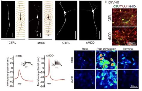 项目文章丨利用单细胞转录组测序等揭示伴有自杀行为的抑郁症的潜在治疗新靶点 知乎