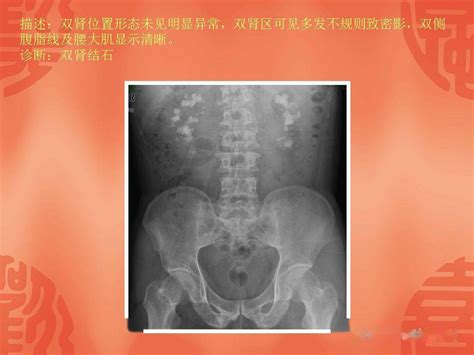 X线入门 初学者一定要记住的32张平片！描述诊断 搜狐大视野 搜狐新闻