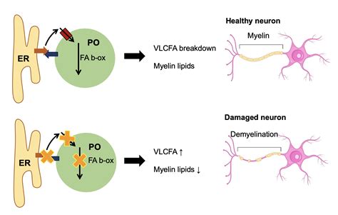Peroxisomes Lipids And Neurodegeneration