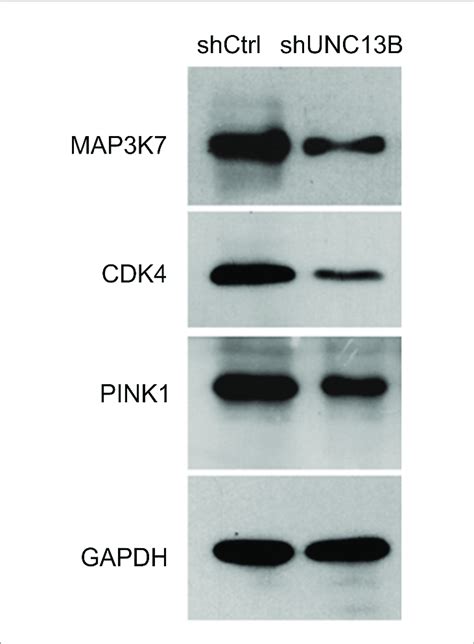 Western Blotting Analysis Of Key Proteins Mediated By Unc13b Download Scientific Diagram