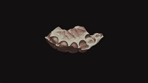 Group 11 Class 3 Tooth 11 Download Free 3d Model By Umdental [0db7d39