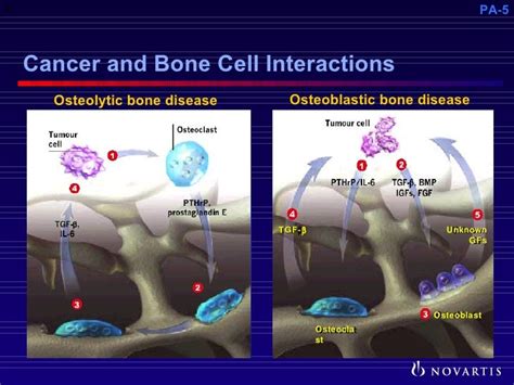 Pathophysiology Of Vmetastatic Bone Disease And The Vrole Of Bisphosp