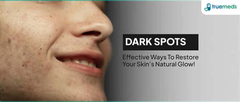 Fersolate Cm Tablet 30 Uses Side Effects Dosage Price Truemeds