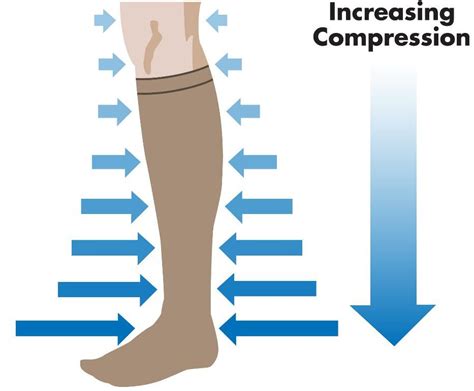 What Is Graduated Compression Do Compression Socks Work