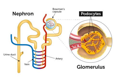 Repairing Podocytes Genetic Factor Could Yield Targets For Treating