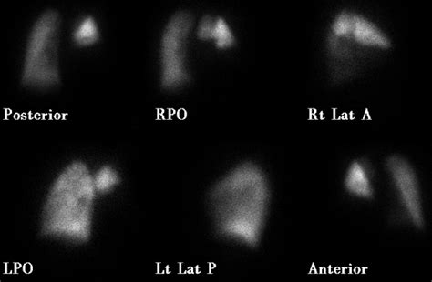 MIR Teaching File Case Vq020