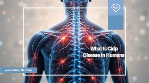 What Is Cidp Disease In Humans Symptoms Causes And Treatment Guide
