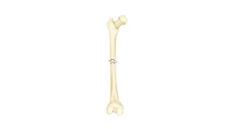 Fracture Types Depuy Synthes