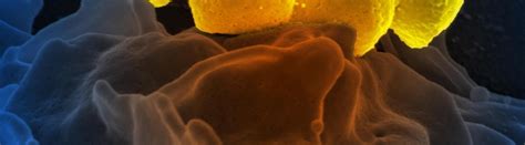 Group A Strep Infection