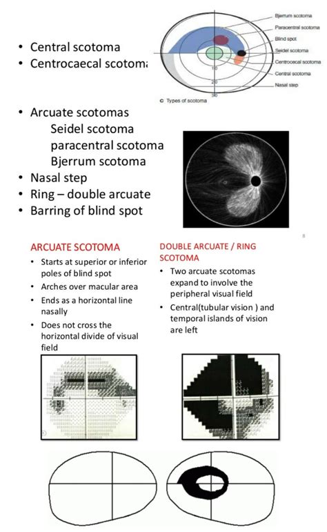 Visual Field Testing From One Medical Babe To Another Artofit