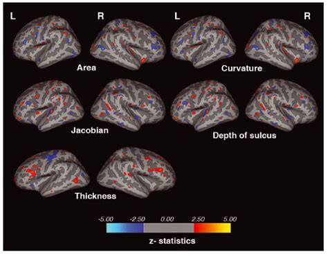 Borderline Personality Disorder Brain Vs Normal Borderline Personality Disorder Brain Vs Normal