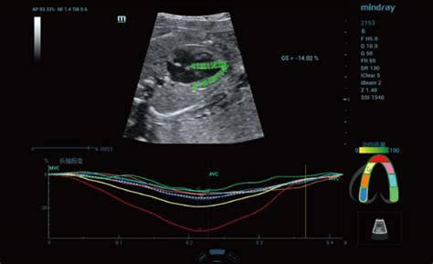 Asset Download Mindray