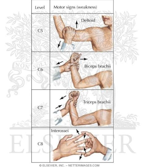 Upper Extremity Manual Muscle Testing