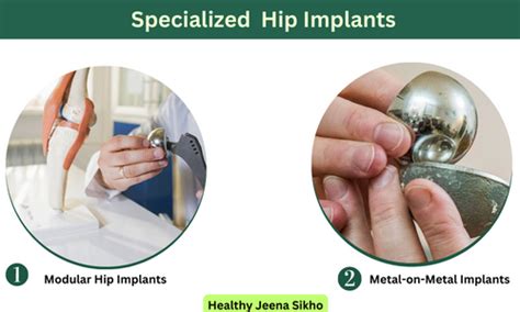 Types Of Hip Implants Exploring Options And Considerations