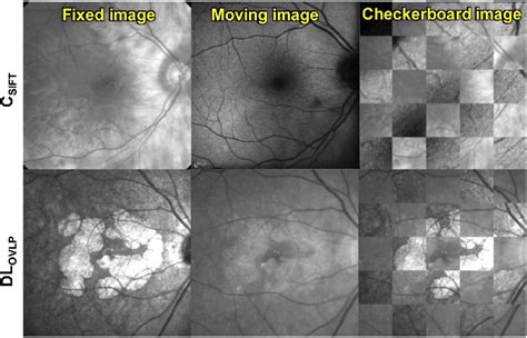 Figure 1 From Deep Learning Based Multi Modal Retinal Image Registration For The Longitudinal