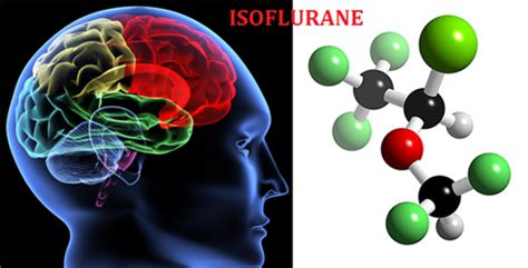 认知功能损害【多图】39医疗图集 39健康网