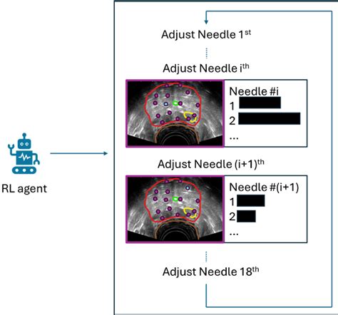 论文评述 Automatic Treatment Planning Using Reinforcement Learning For High Dose Rate Prostate