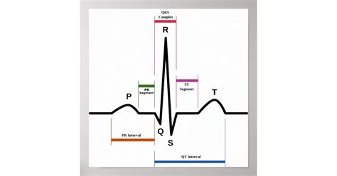 Poster Sinus Rythm Electrocardiogramme Ecg Diagram Zazzlefr