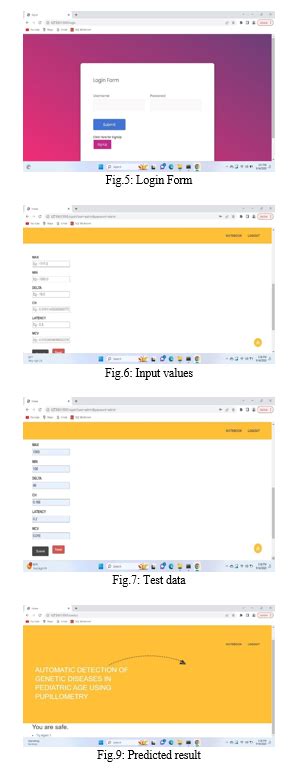 Automatic Detection Of Genetic Diseases In Pediatric Age Using Pupillometry