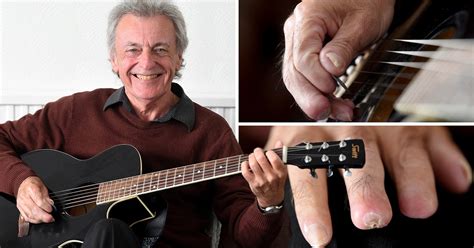 Tony Iommi Prosthetic Fingers