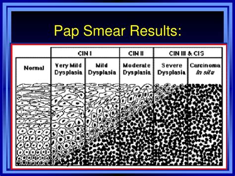 Ppt Infection Par Le Papillomavirus Humain Hpv Powerpoint