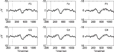 Difference Waves By Arithmetic Subtraction Of Waveforms Shown In Figure