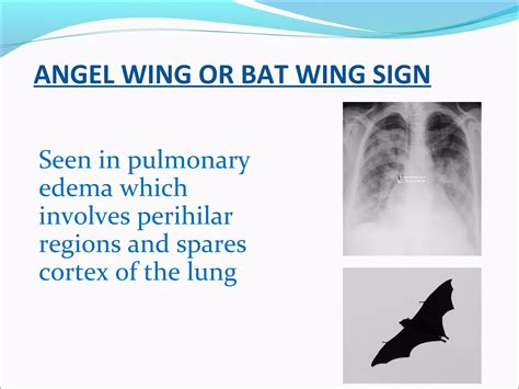 Radiology Signs Ppt