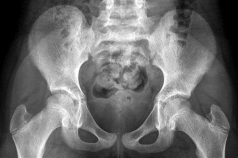 კაქტუსი ორსულობისა და ბავშვის გაჩენის გავლენა ახალგაზრდა გოგონას სხეულზე