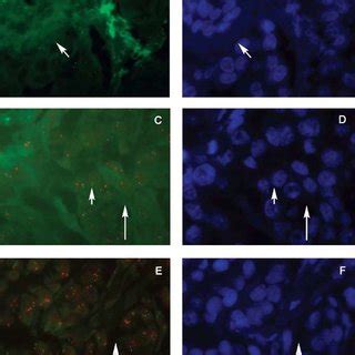 Nuclei DAPI Counter Stains Of FFPE Breast Tissue At Different Digestion Download Scientific