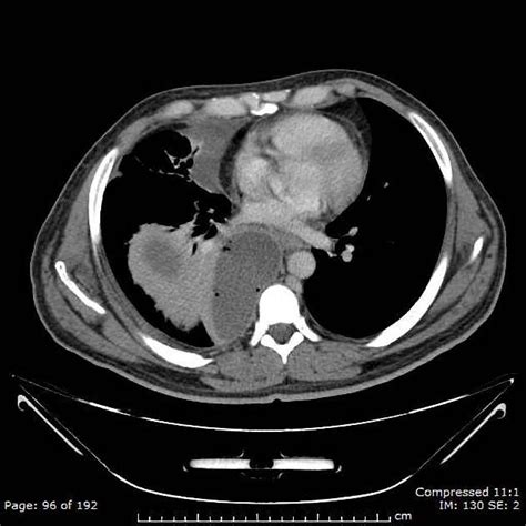 Pin On Radiologic Anatomy