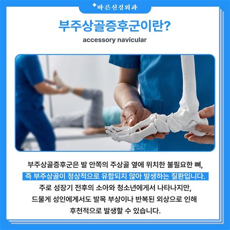 부주상골증후군 완벽 가이드 증상 원인 치료 예방
