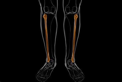 Fibula Stress Fracture Mri
