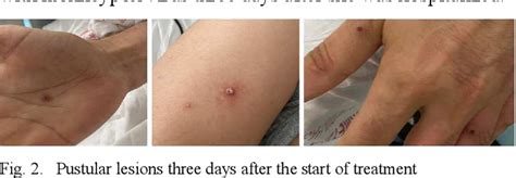 Figure 1 From Optimization Based Feature Selection In Deep Learning